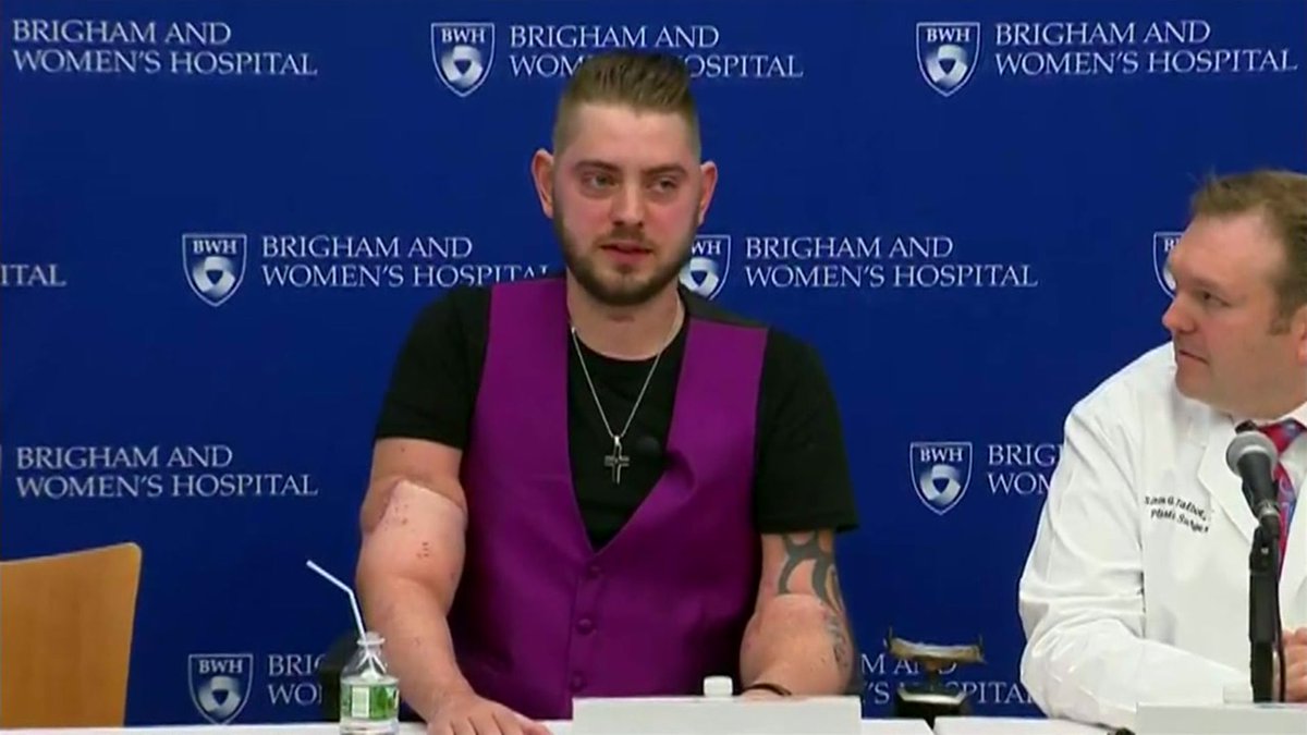 Retired Marine Sergeant John Peck says double arm transplant will allow ...