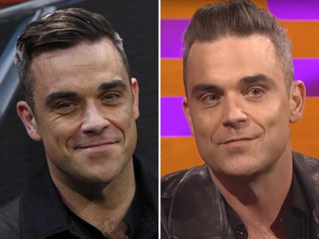 Robbie williams, botox choc «adesso non riesco più a muovere la fronte ...