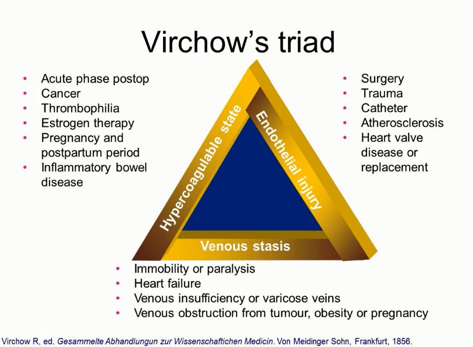 Virchows Triad Virchow Triad