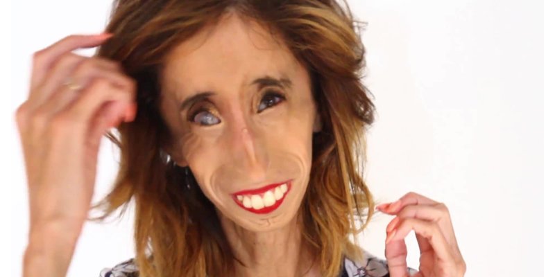 Ugliest Person In The World