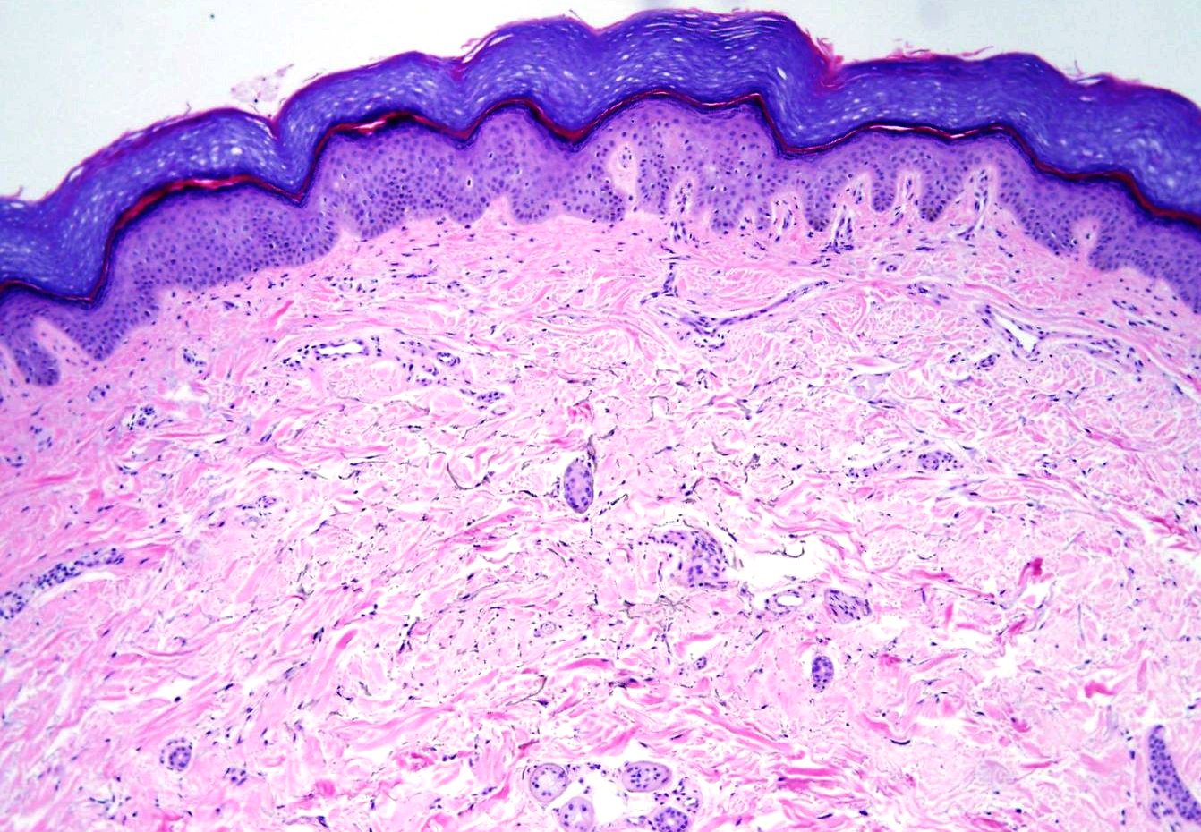 Argyria Histology