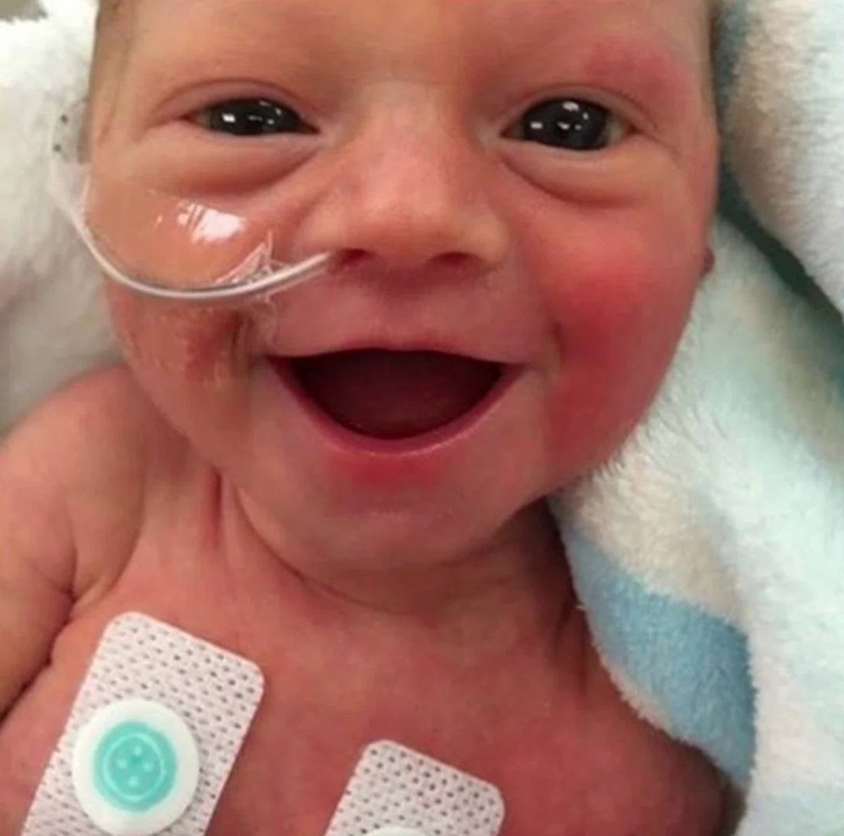 This photo of a premature baby smiling might just make your day ...