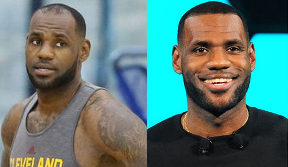 Lebron Hairline Before And After