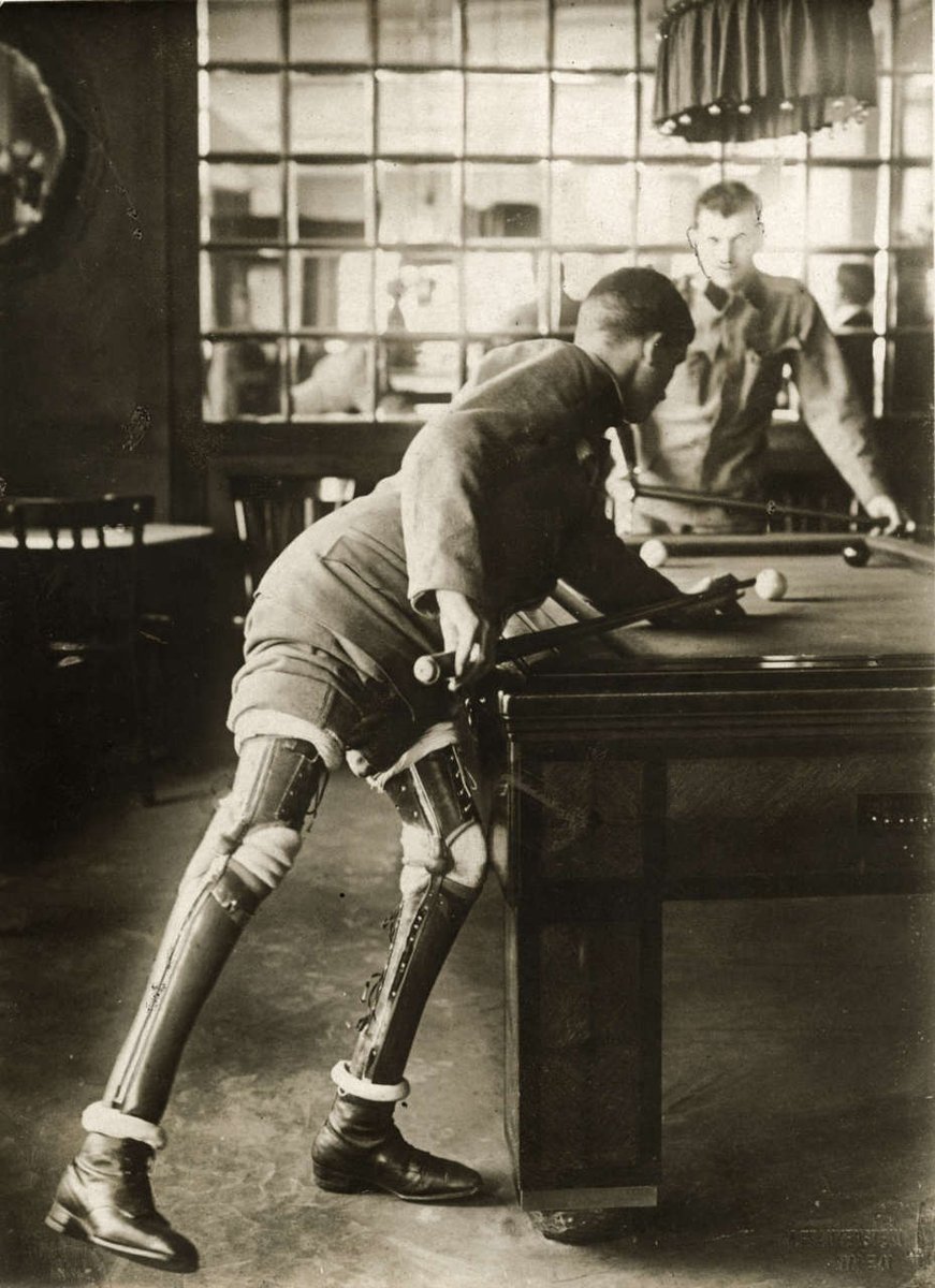 World War I soldier, a double amputee, plays billiards with prosthetic ...