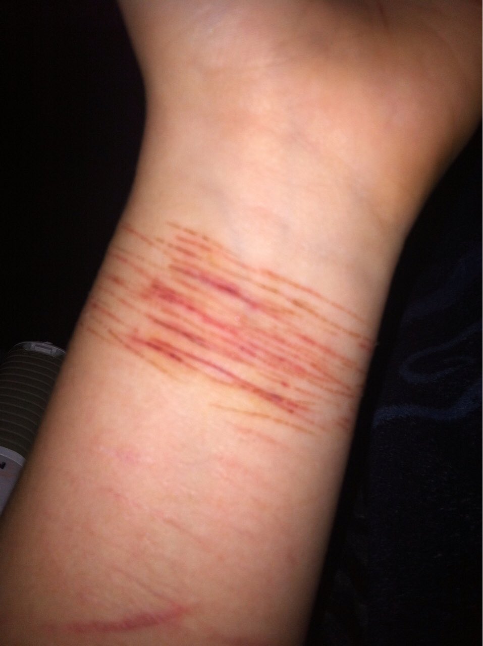 Love Arm Cuts