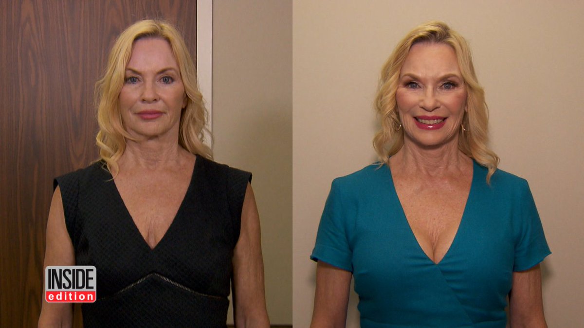This 70 Year Old Granny Decided To Get Breast Implants Because She