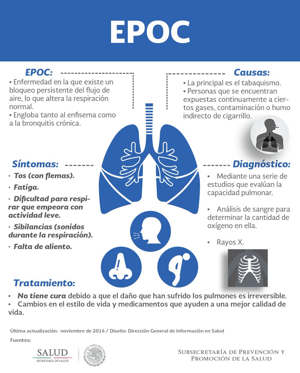 EPOC: todas las noticias de última hora, fotos y vídeos en tiempo real ...