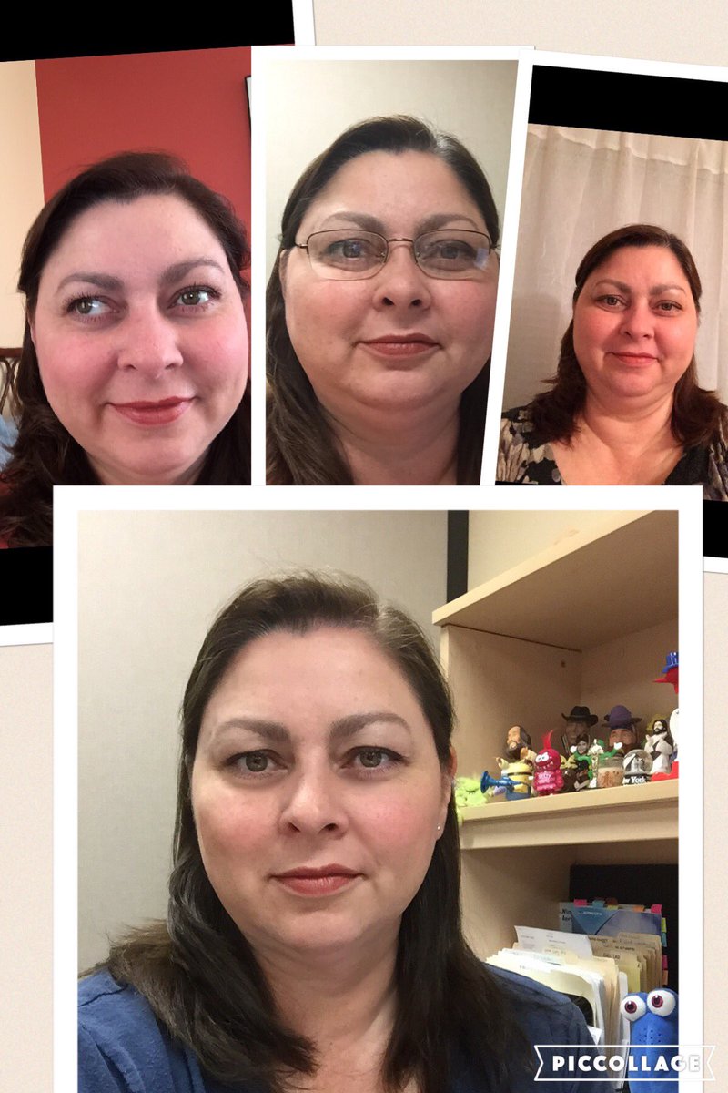 Prednisone Moon Face