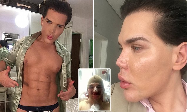 Meet the real-life ken doll whose body rejected his new nose ...