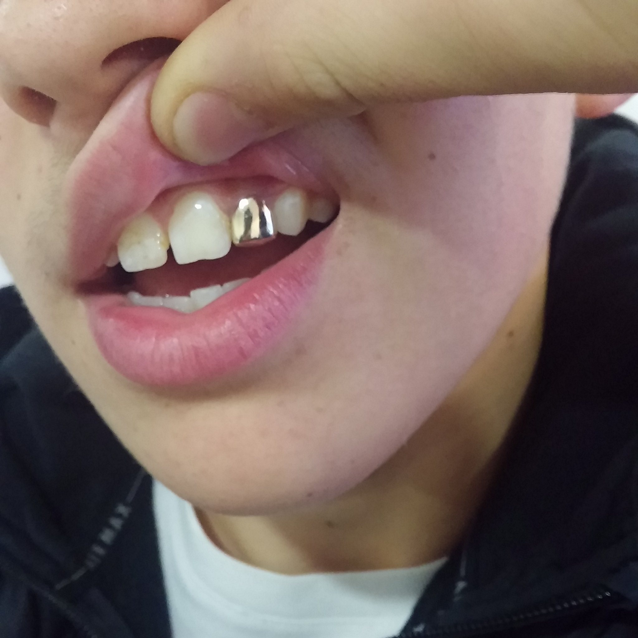 Removable Gold Tooth Cap