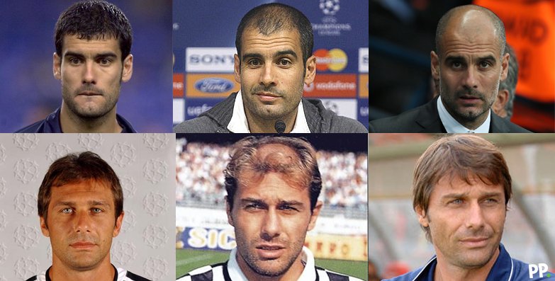 Pep Guardiola Hair