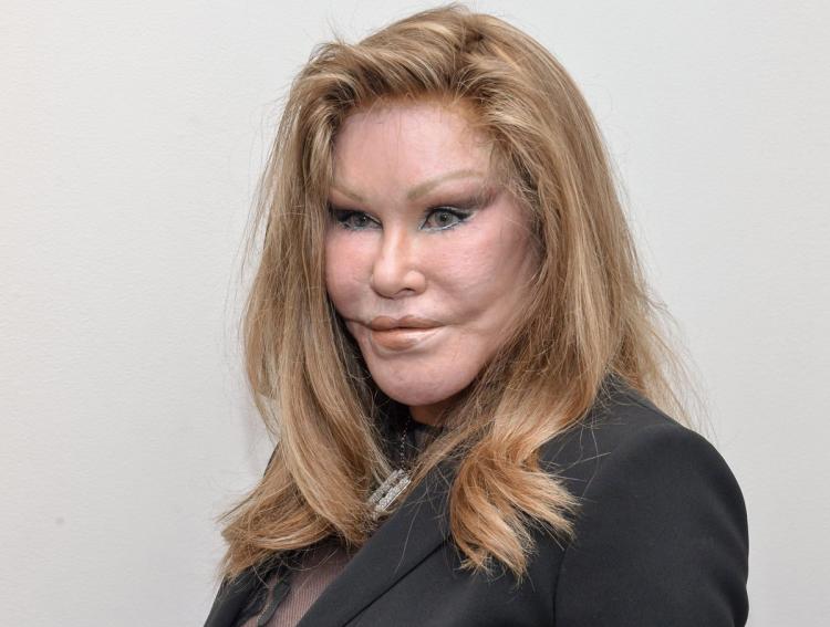 Cat Woman Plastic Surgery To Look A Like