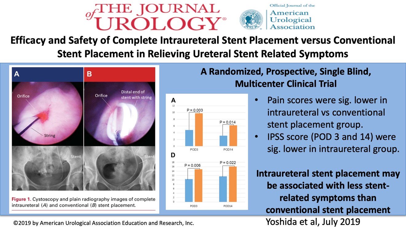 Urethral Stent Placement
