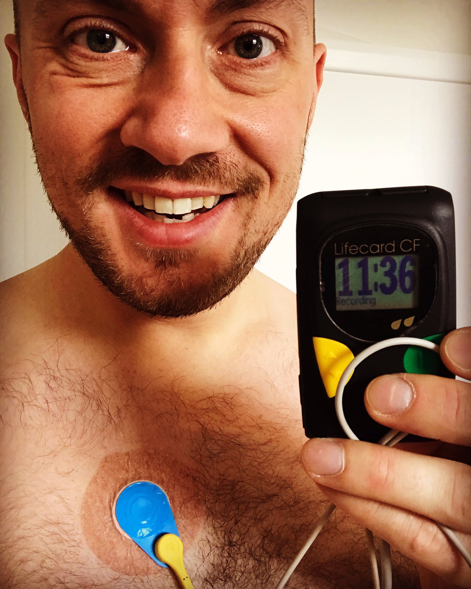 24-hour Holter Monitoring: Uses, Results, And What To, 40% OFF