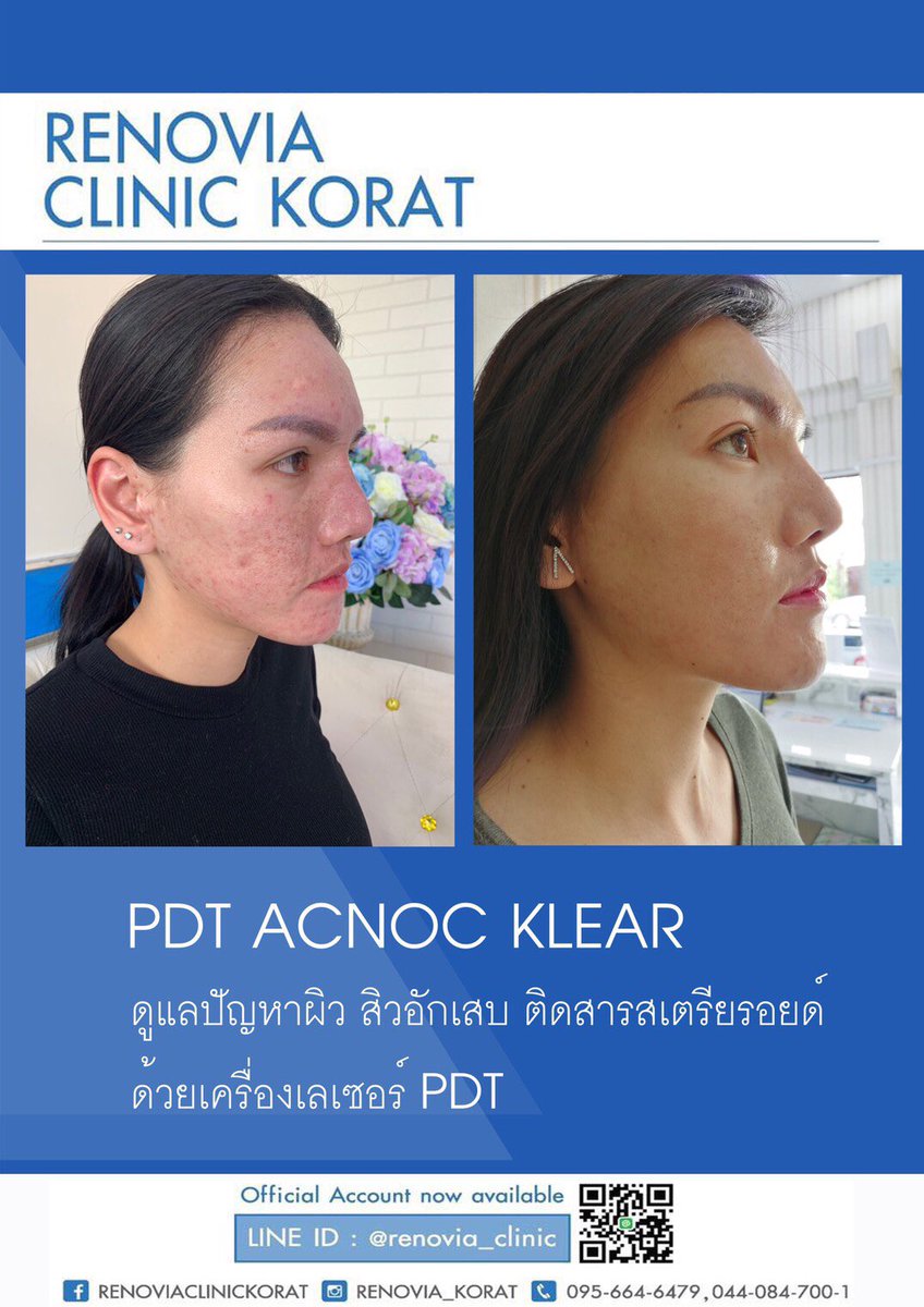 Renovia Clinic Korat (@ClinicRenovia) | Twitter