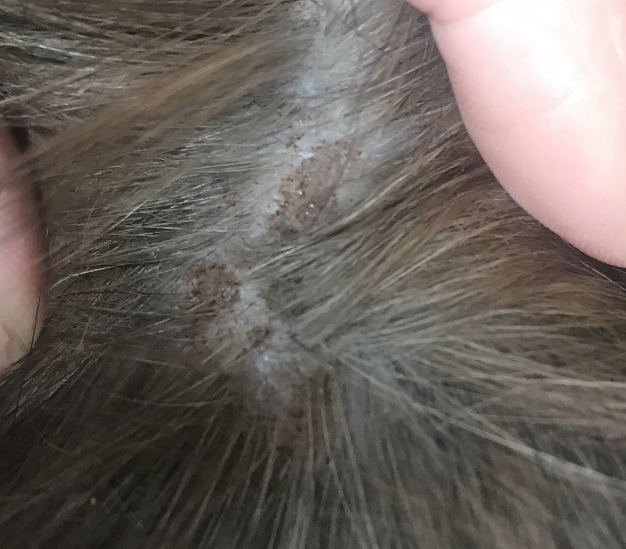 Susan Smyth On Twitter My Cat Has A Scaly Rash The Entire Length Of susan-smyth-on-twitter-my-cat-has-a-scaly-rash-the-entire-length-of