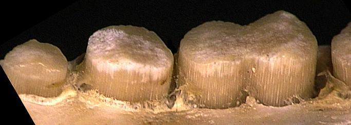 Aardvark Teeth