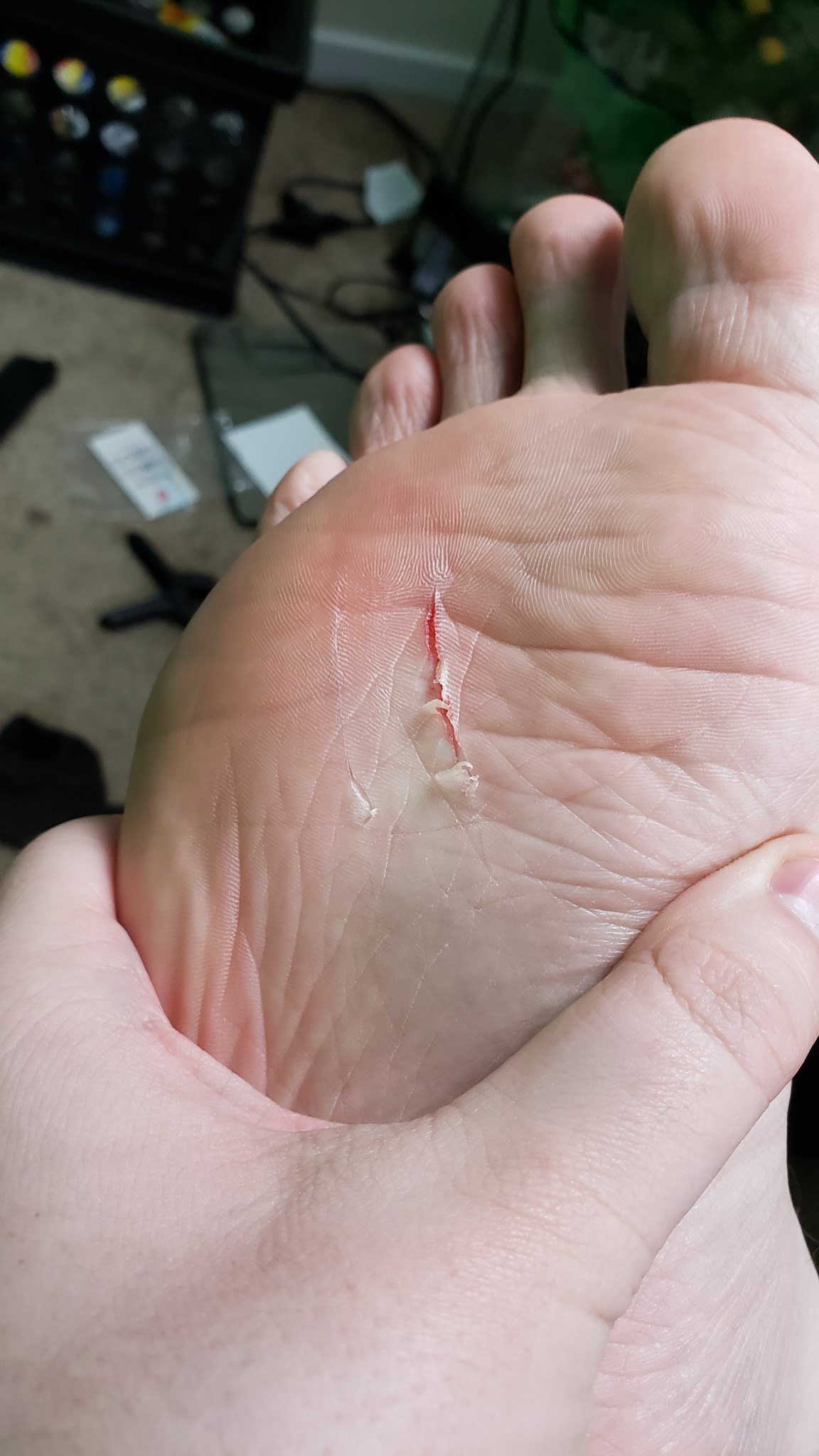 Cut On Ball Of Foot Factory Sale | emergencydentistry.com