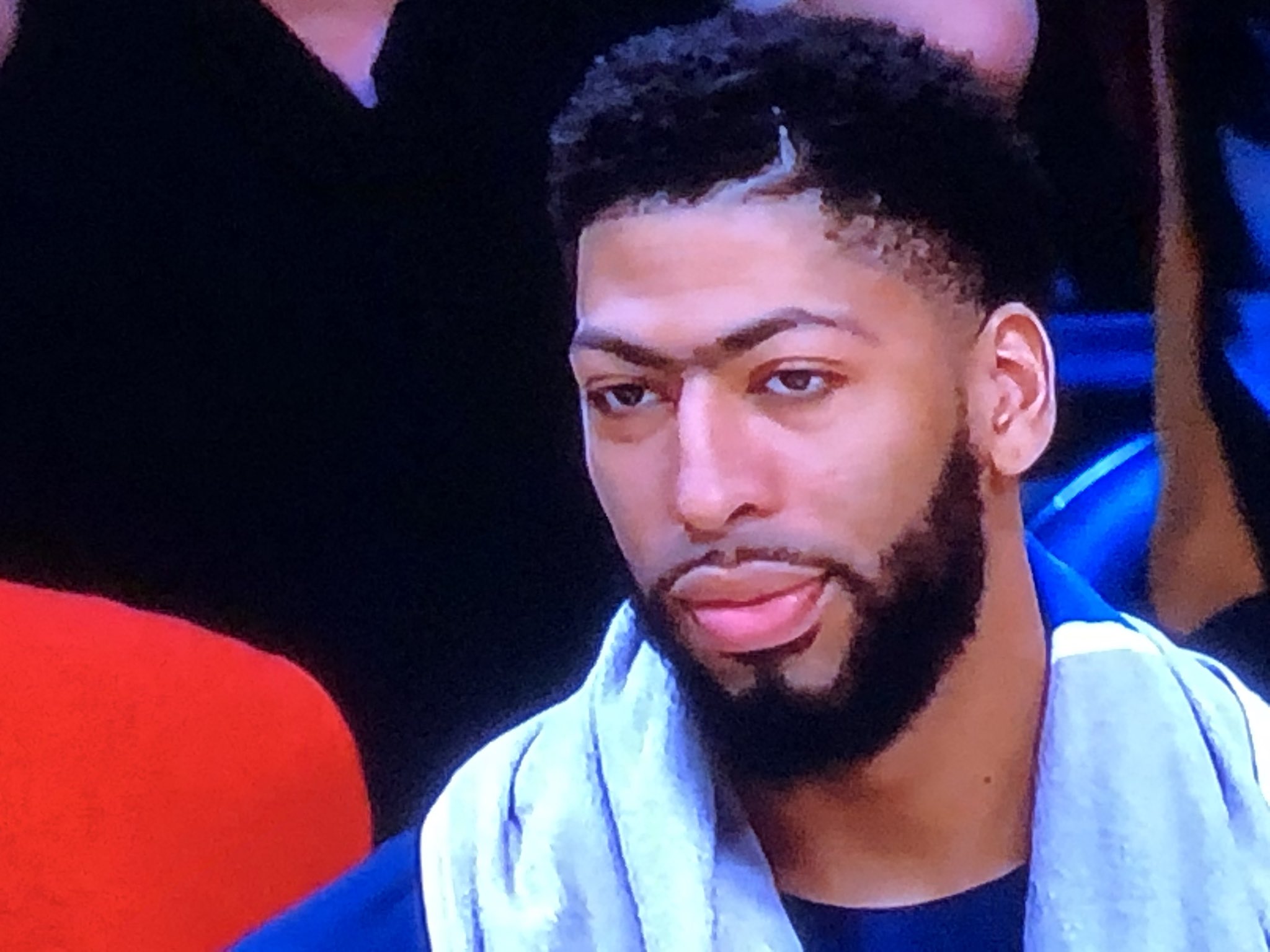 Anthony Davis Braces
