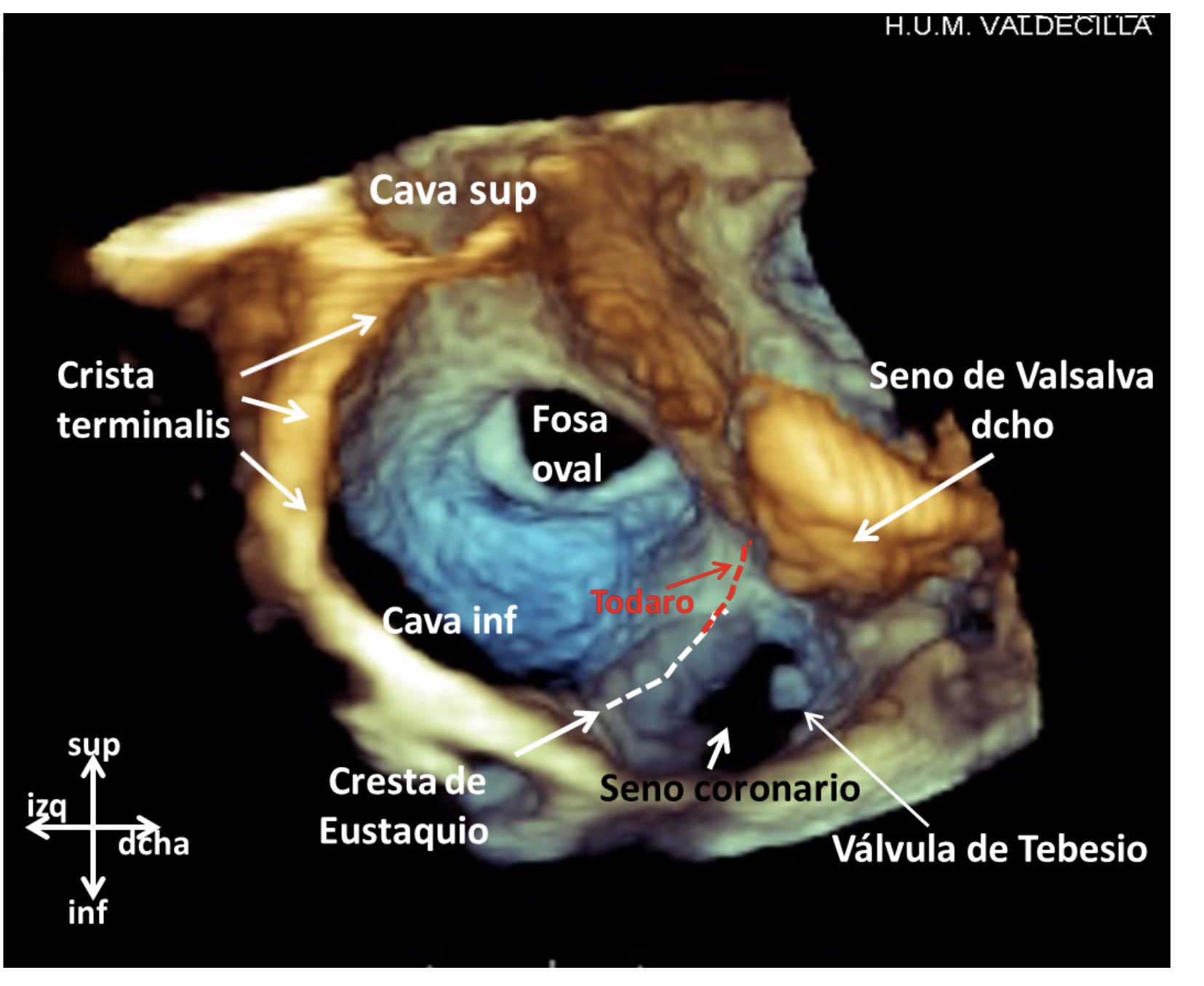 Anatomía De La Aurícula Derecha Apunte: Corazón | Anatomía Normal