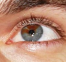 Henry Cavill Heterochromia