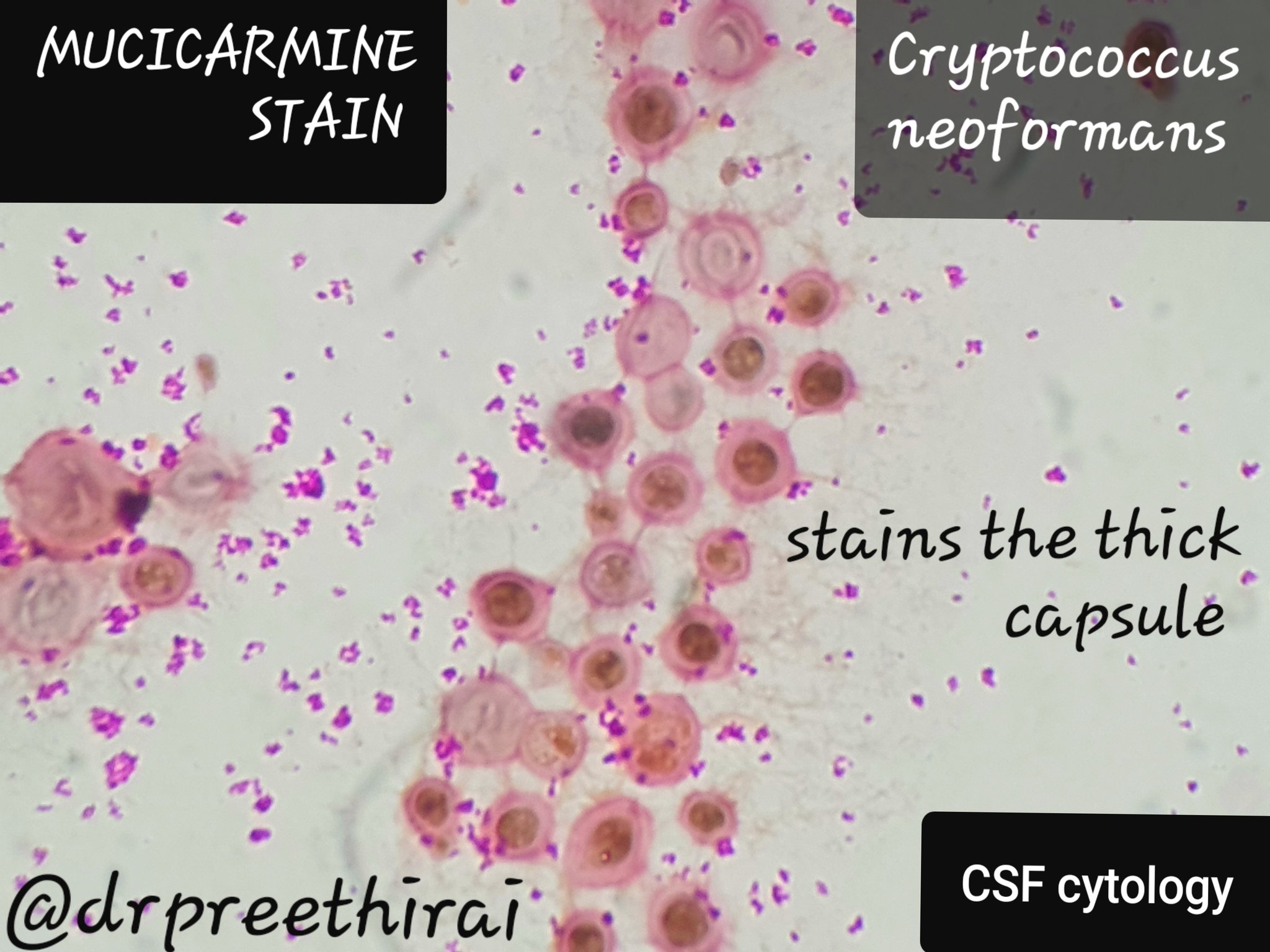 Round Yeast Gram Positive Cryptococcus Neoformans Gra - vrogue.co