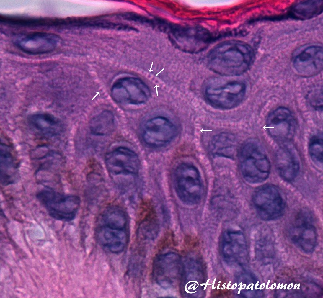 Desmosomes Histology