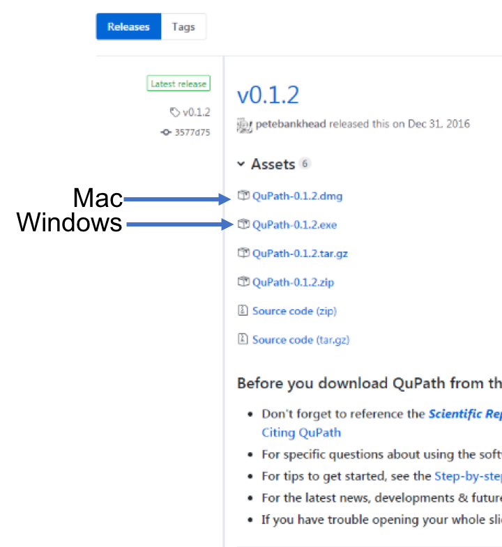 A Thread From Path Matt 1 I Am A Relatively Basic Qupath User But
