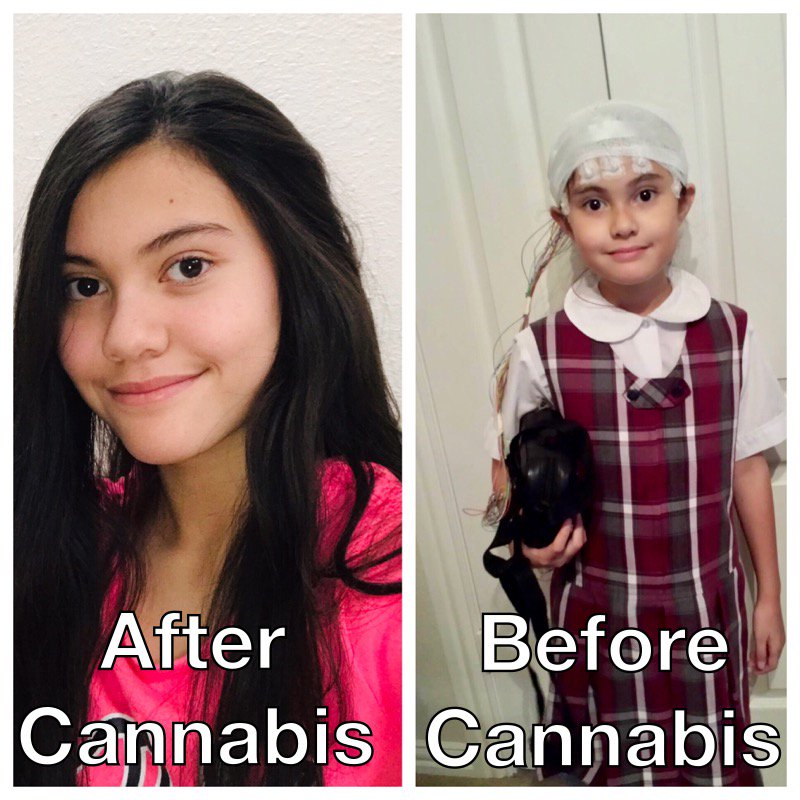 Before And After Weed