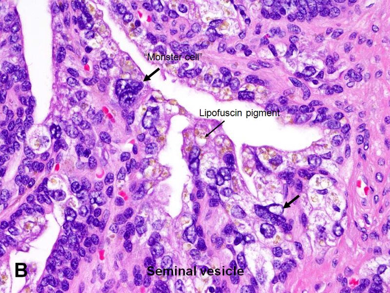 Seminal Vesicle Histology Lipofuscin