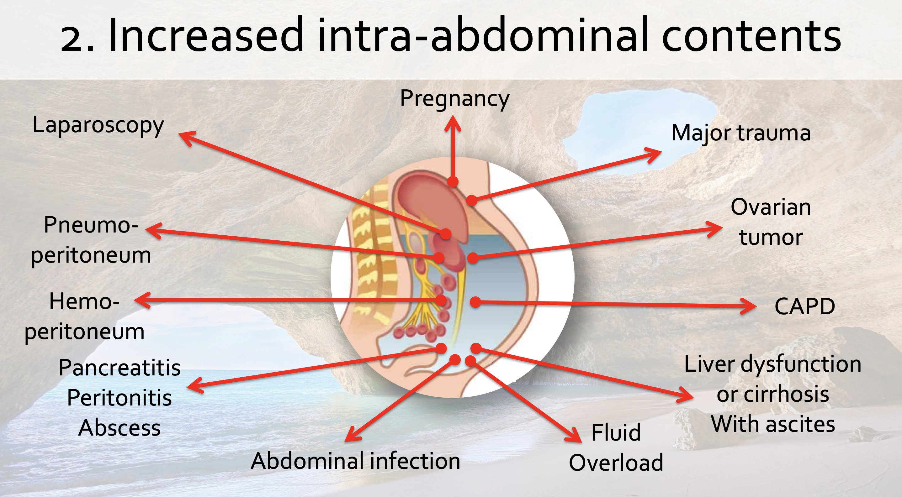 Intra Abdominal Abscess