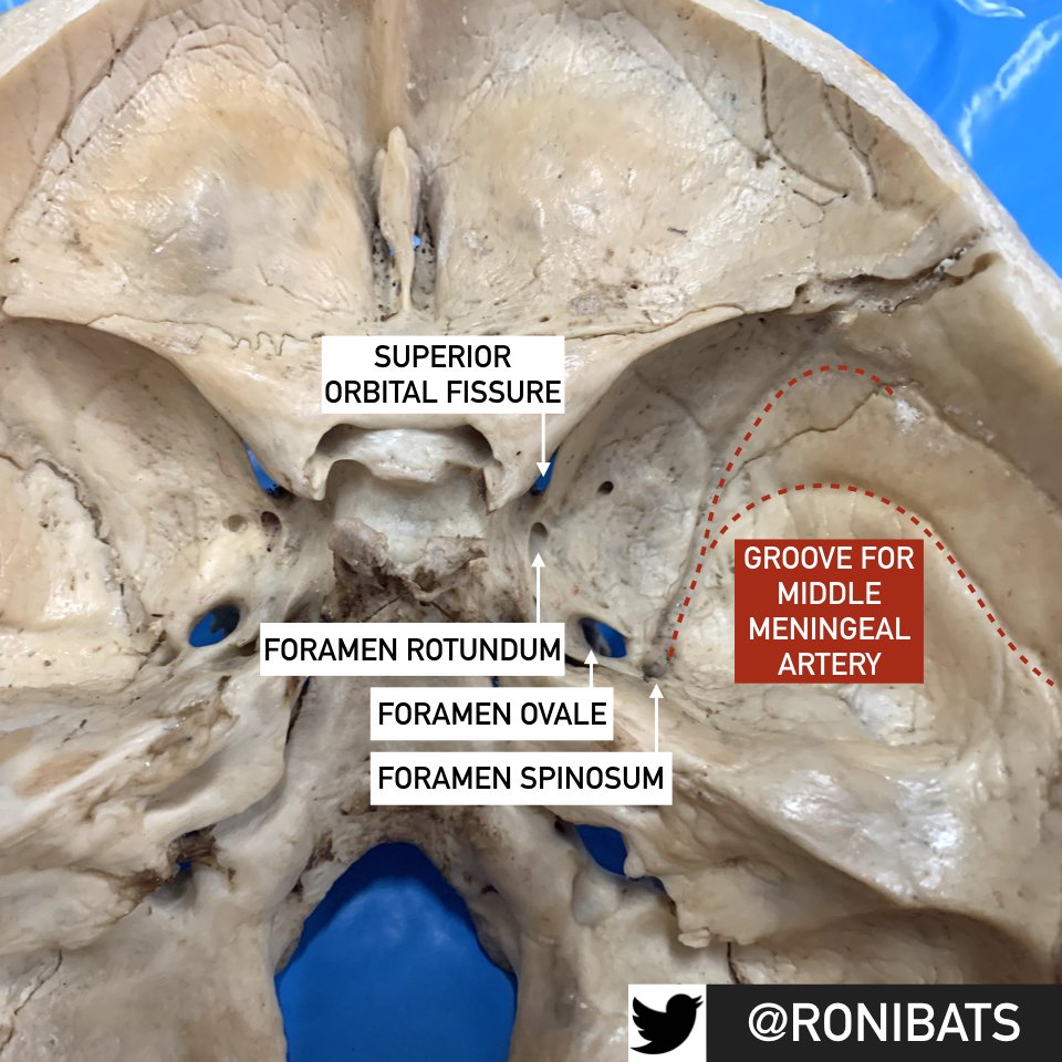 Groove For Middle Meningeal Vessels at Jordan Biddle blog