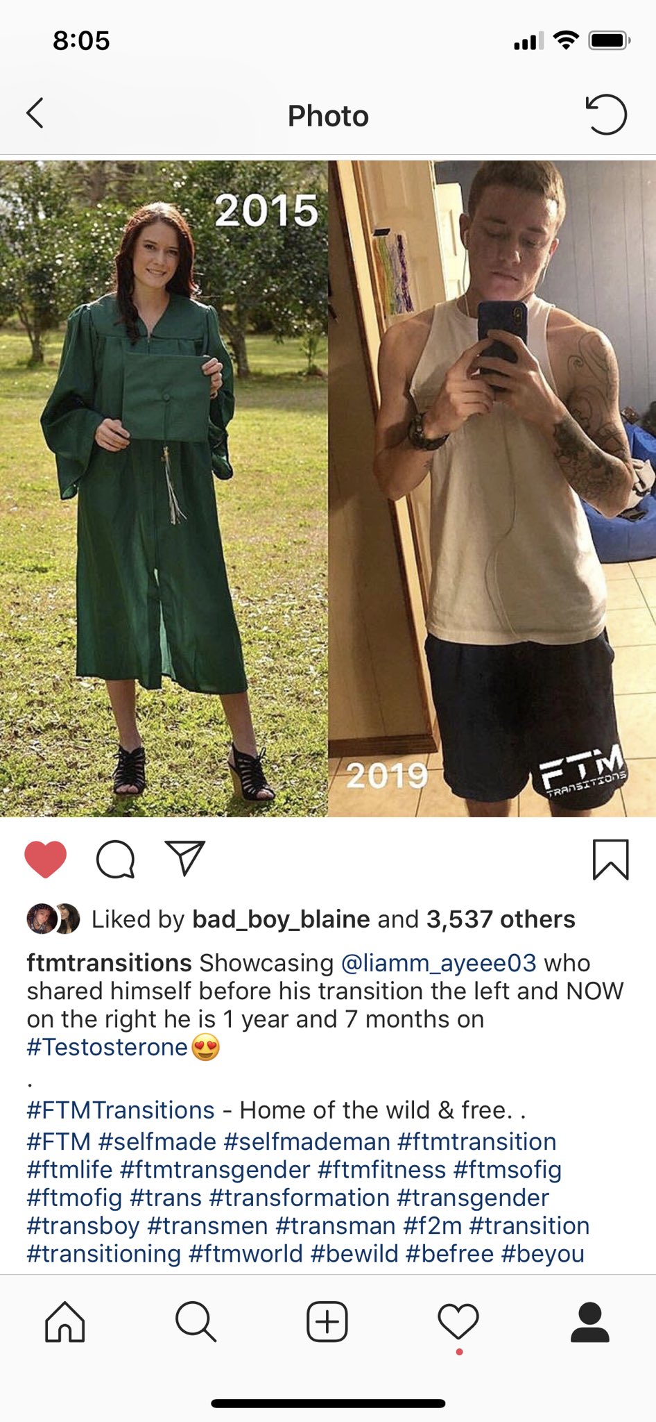 Ftm Transition Before And After