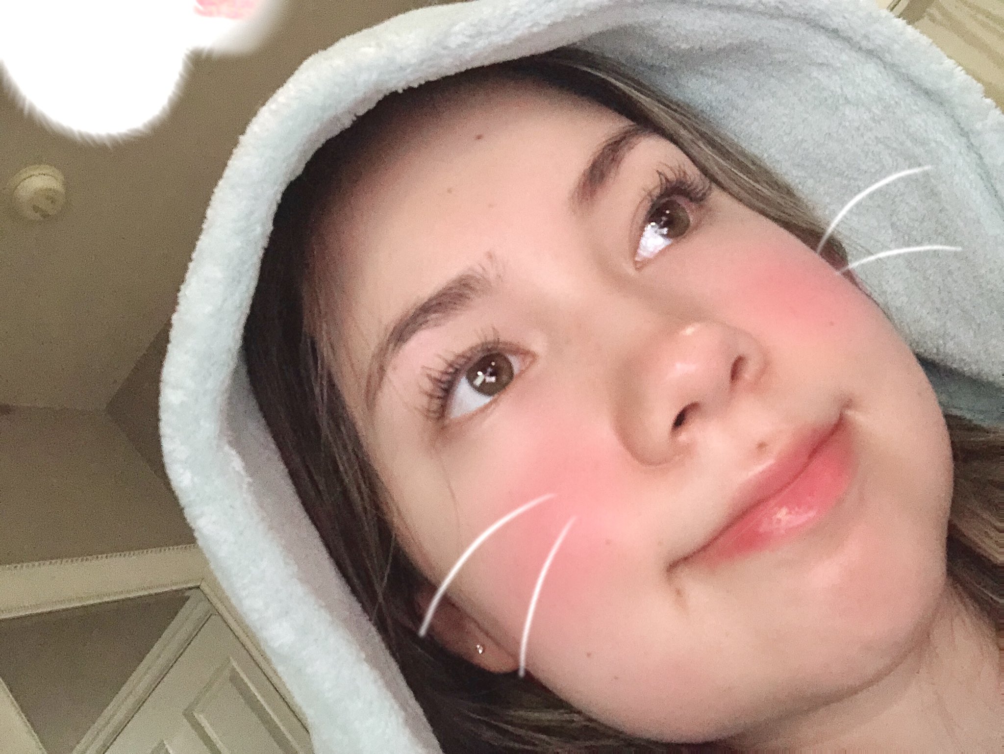 QuarterJade on Twitter: "If you’re wondering how my recovery is going, let’s just say I’ve ...