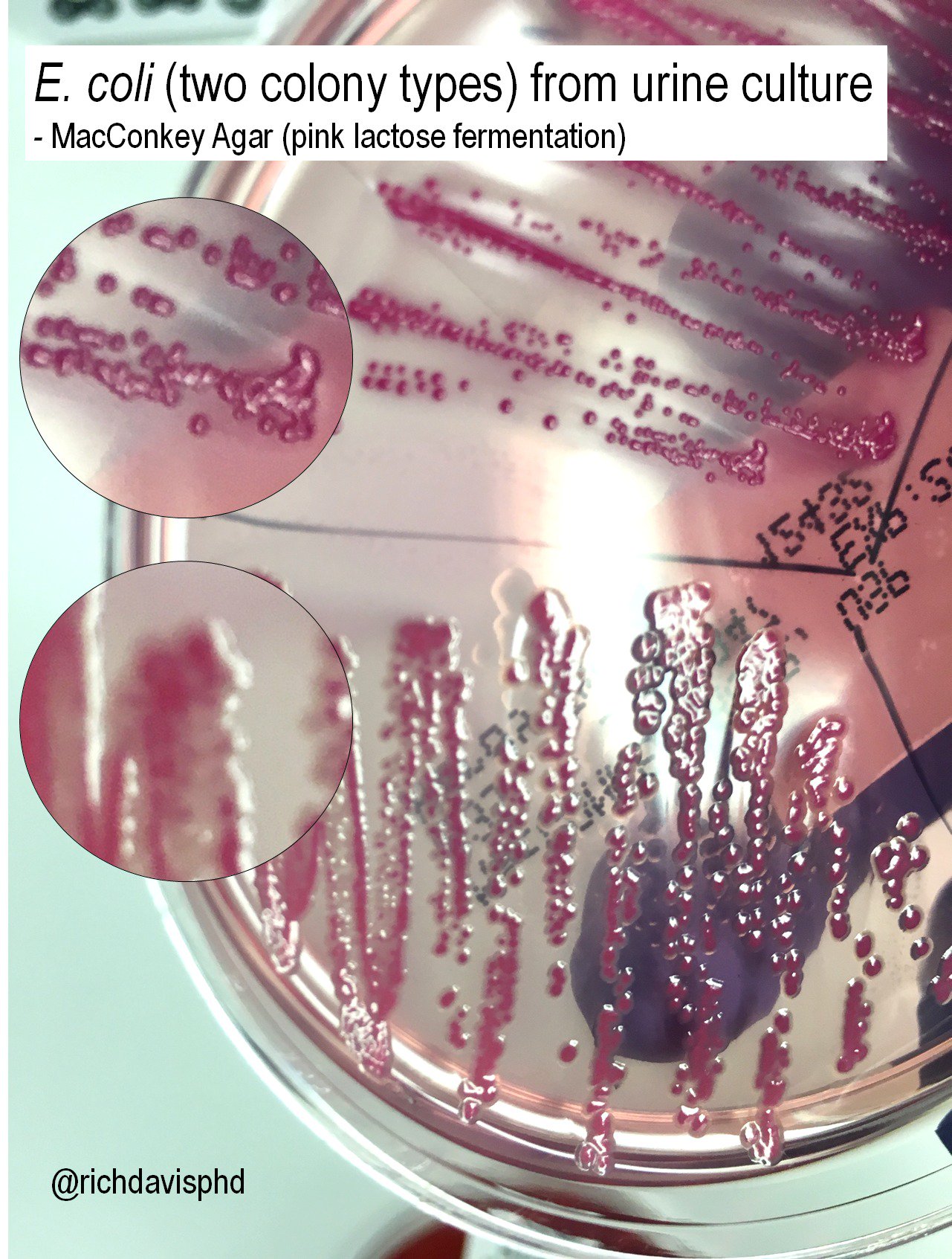 E Coli Plate Morphology
