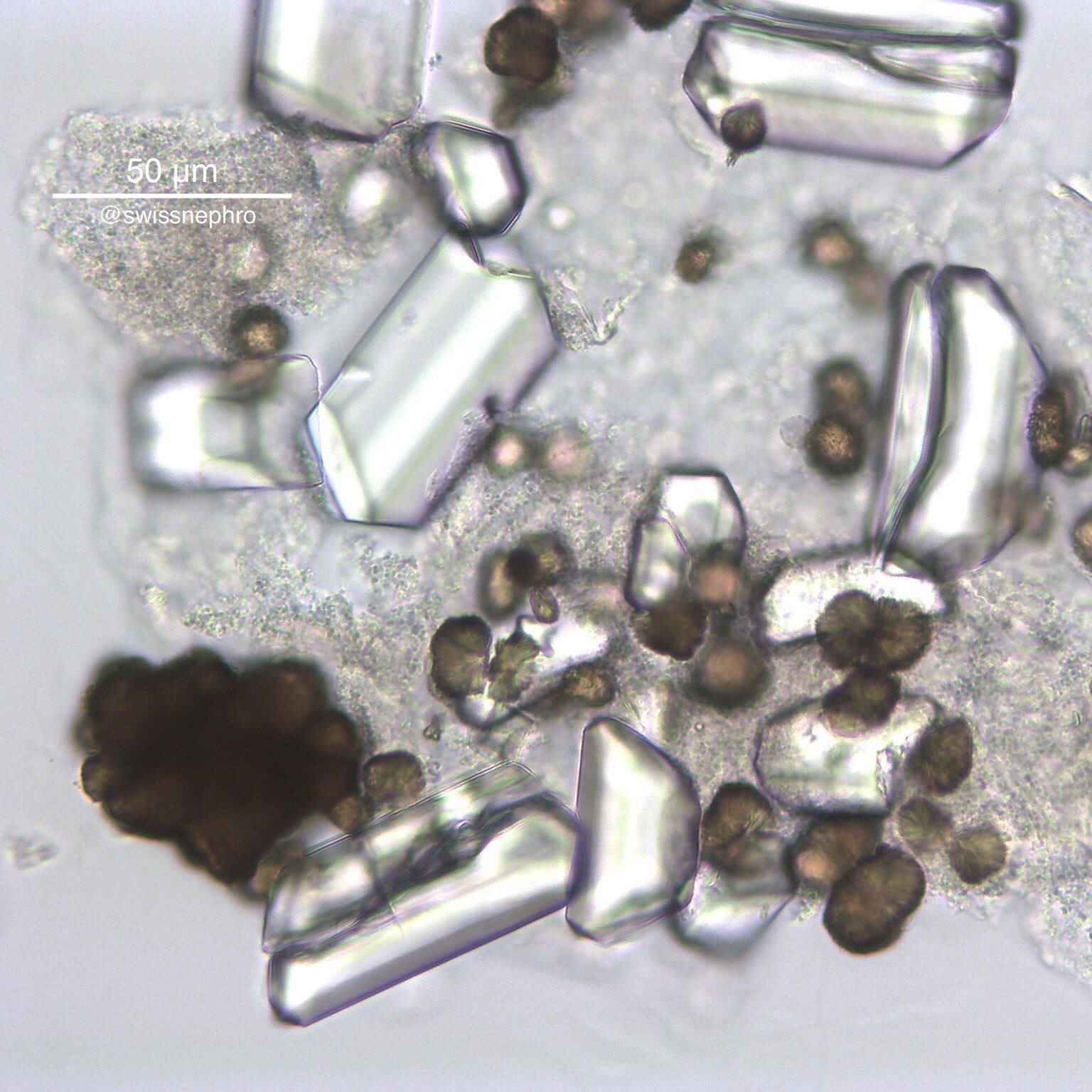 Magnesium Phosphate Crystals