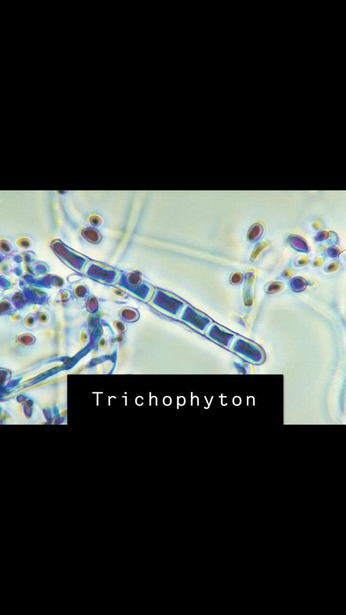 Fungi 🔬 - Thread from غيداء طلال بصفر🇸🇦 @ghayda_basfar - Rattibha