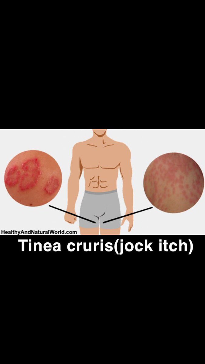Fungi 🔬 - Thread from غيداء طلال بصفر🇸🇦 @ghayda_basfar - Rattibha