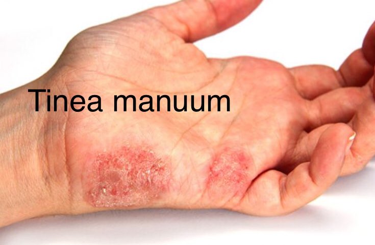 Fungi 🔬 - Thread from غيداء طلال بصفر🇸🇦 @ghayda_basfar - Rattibha