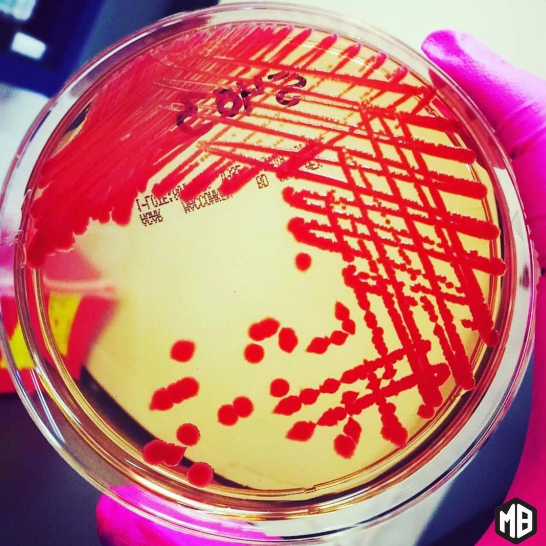 Serratia Marcescens On Macconkey Agar