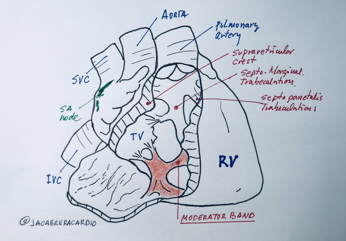 Moderator Band Diagram