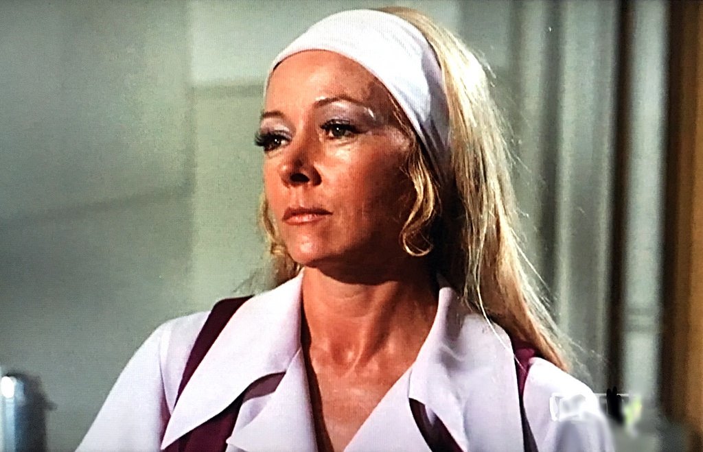 Gloria Grahame Lip Before And After