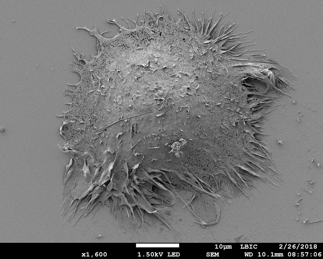 Scanning Electron Microscope Color Cells