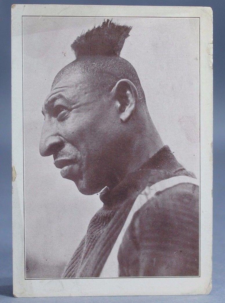 Circus Freaks Pinheads