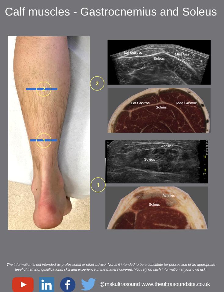 Ultrasound guided injections of the wrist and hand - The Ultrasound Site