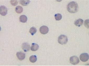 Reticulocyte Vs Heinz Body