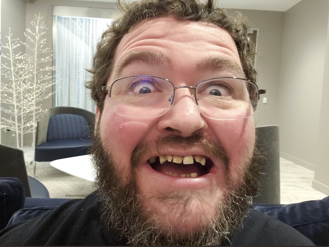 I really want fake teeth | Page 2 | Sherdog Forums | UFC, MMA & Boxing ...