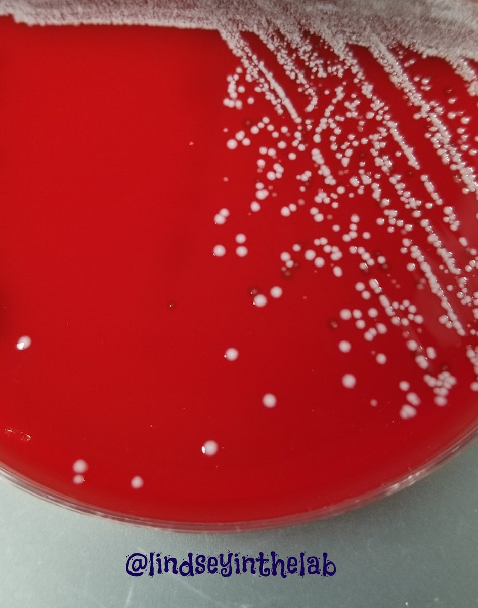 Culture on BAP from sputum specimen. What's your next move #micro ...