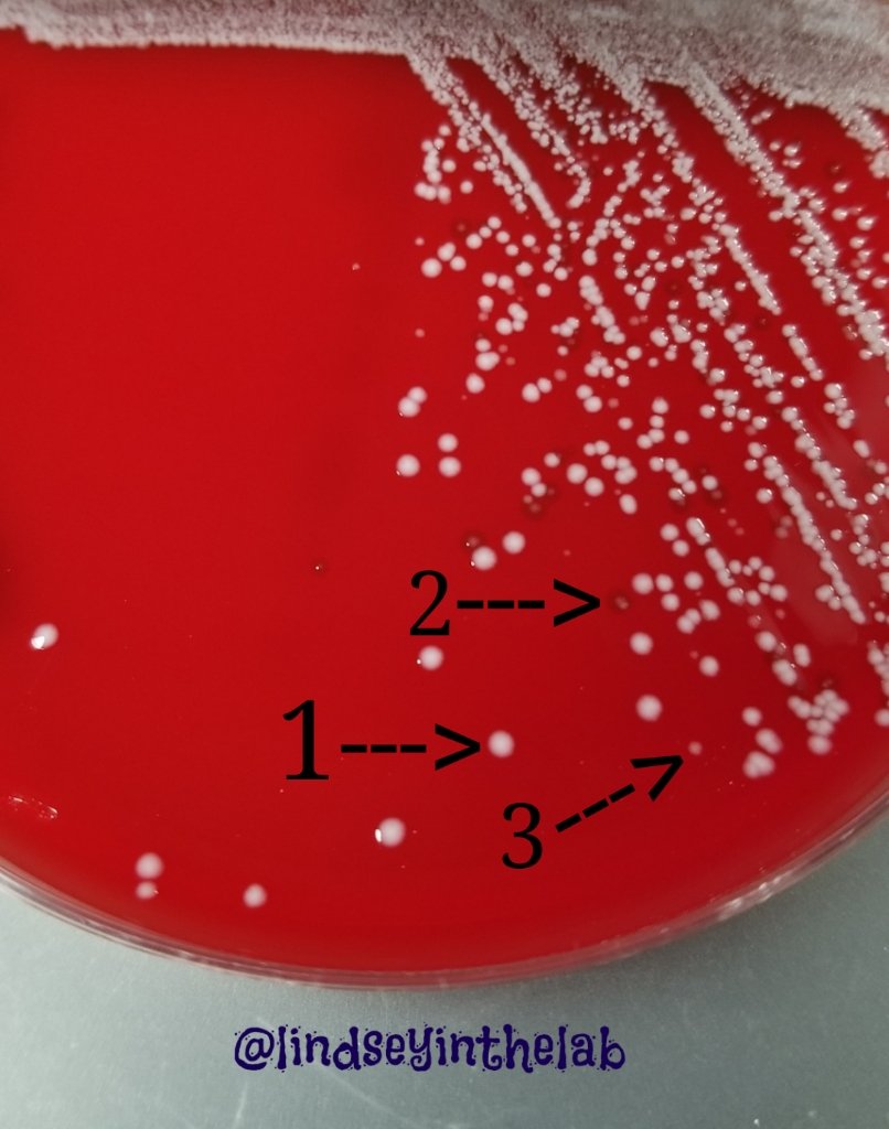 Culture on BAP from sputum specimen. What's your next move #micro ...