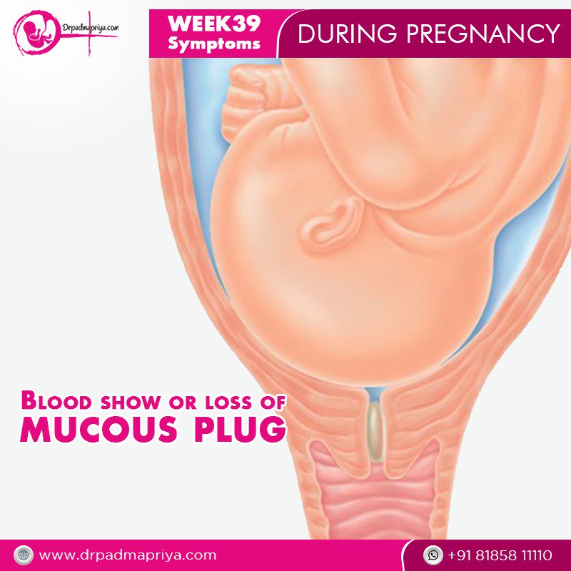 Human Mucus Plug Discharge
